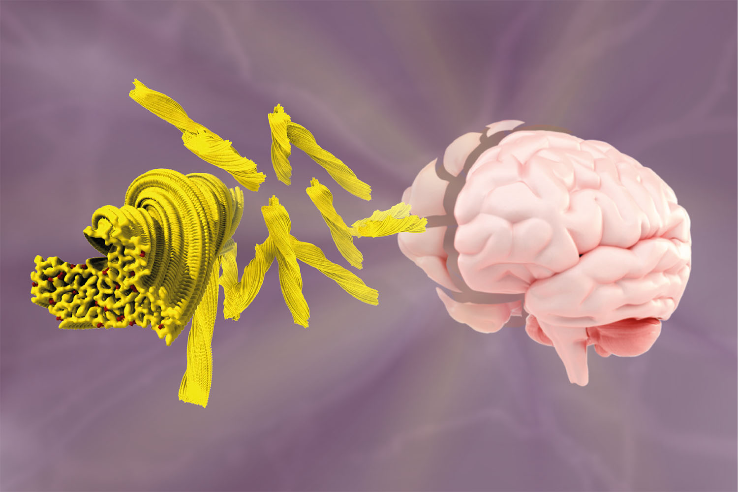 New protein linked to early-onset dementia identified – UKRI