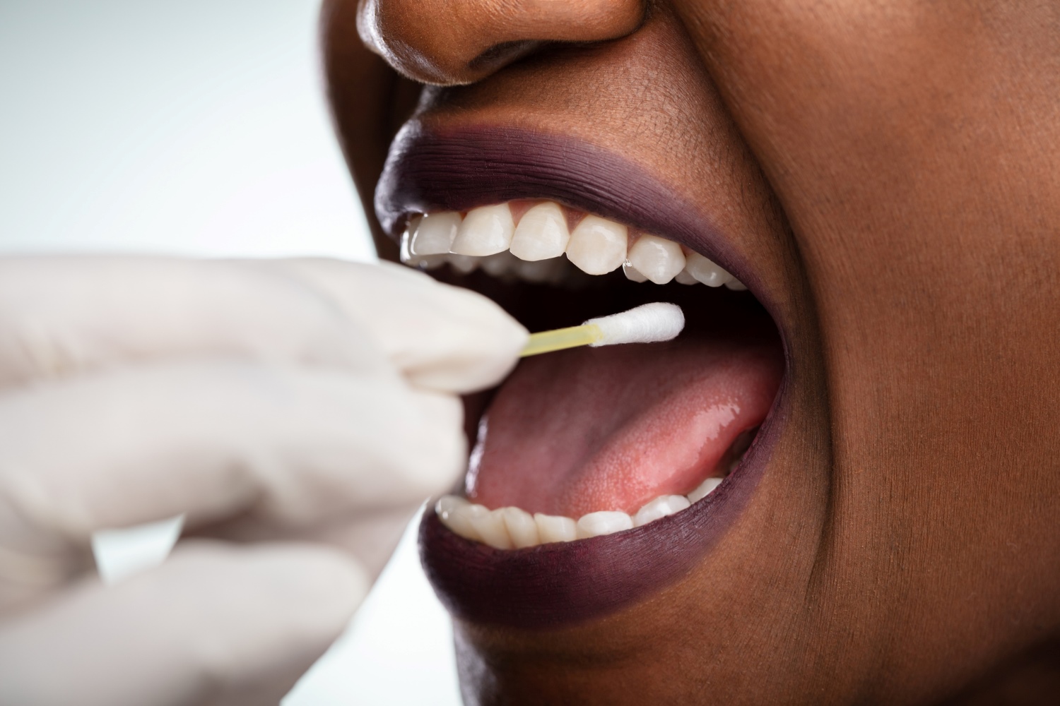 New saliva test can rapidly identify paracetamol overdose – UKRI