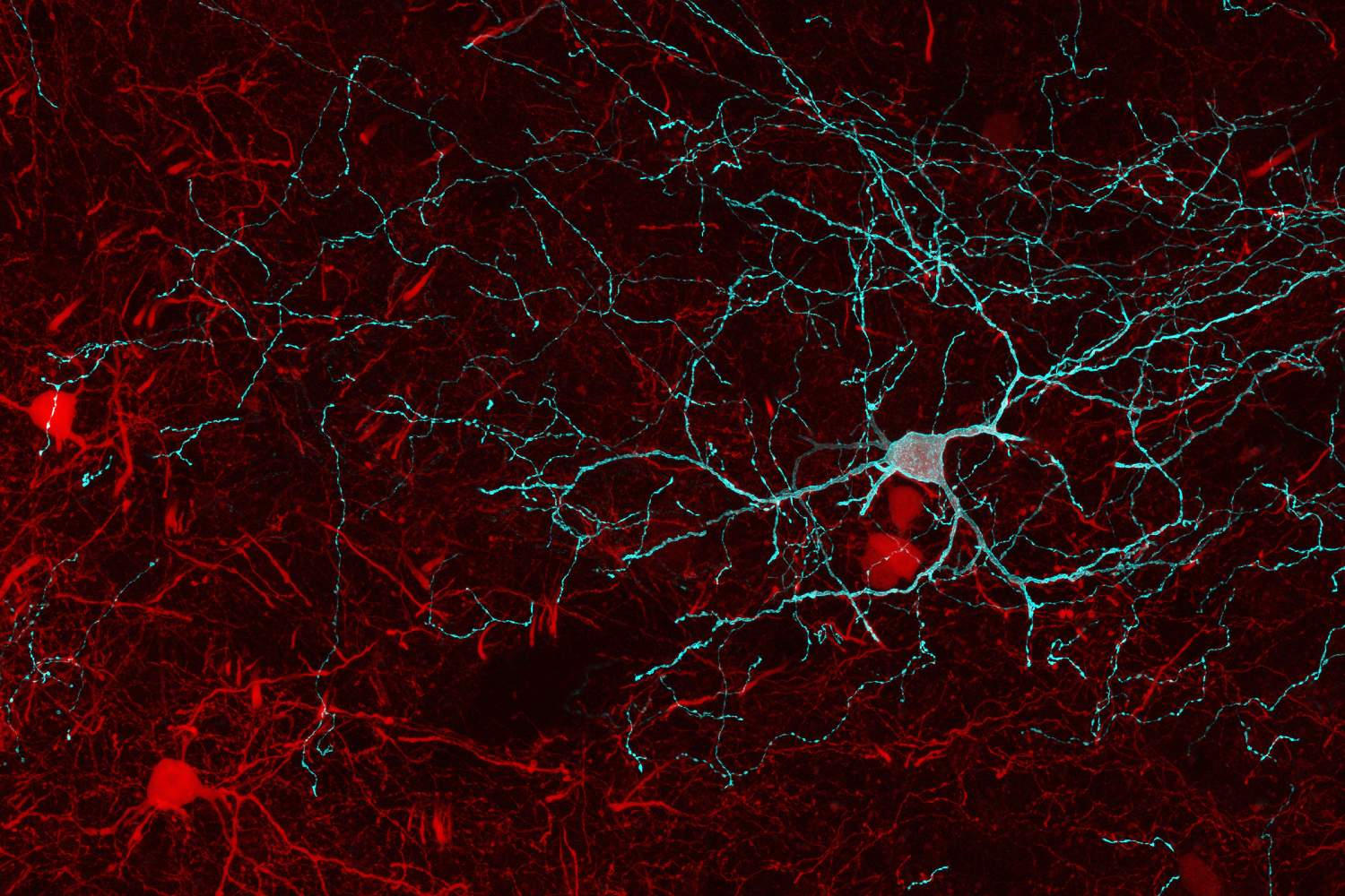 MRC centre to develop brain stimulation device-based therapies – UKRI